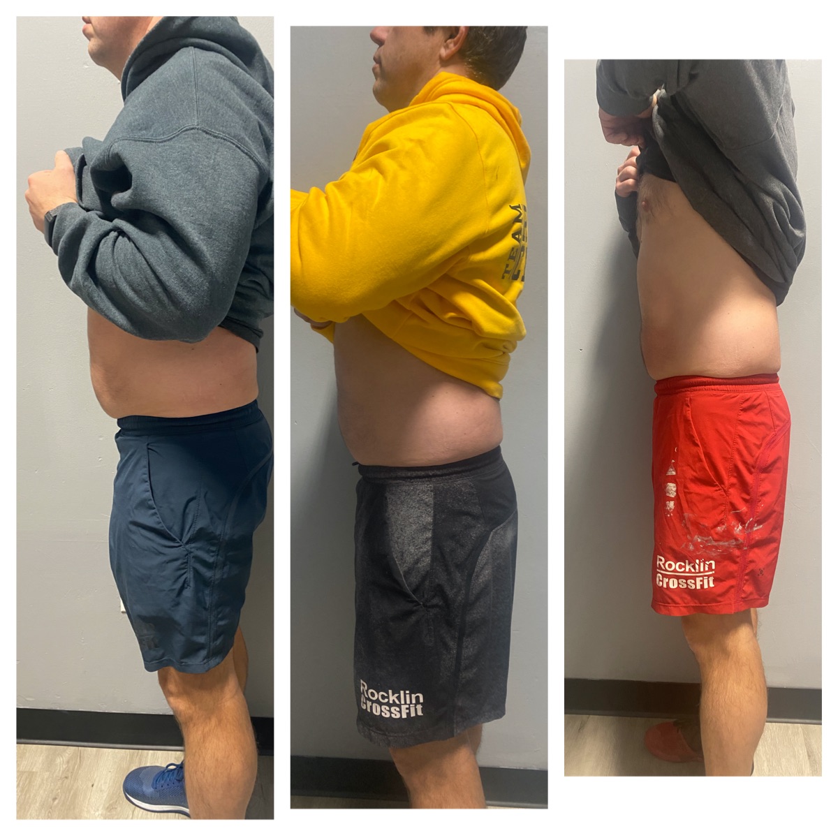 CryoSlimming, CryoToning, and CryoFacial Results | NorCal CryoSlim