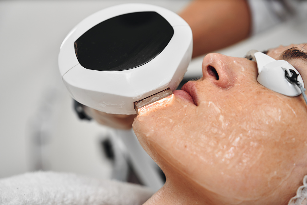 What to Do Before Your IPL Treatment | MOBO Med Spa
